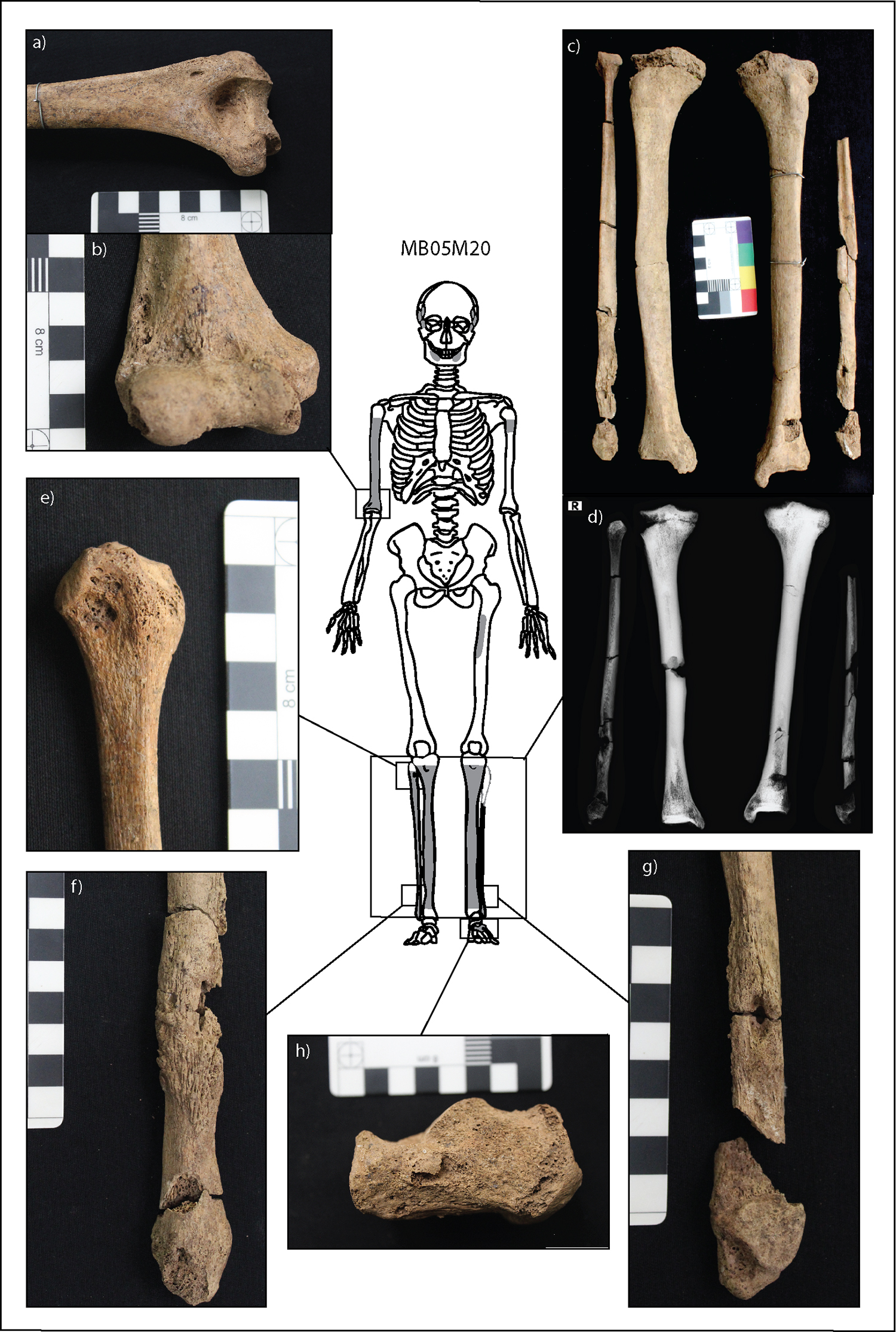 Bioarchaeology International