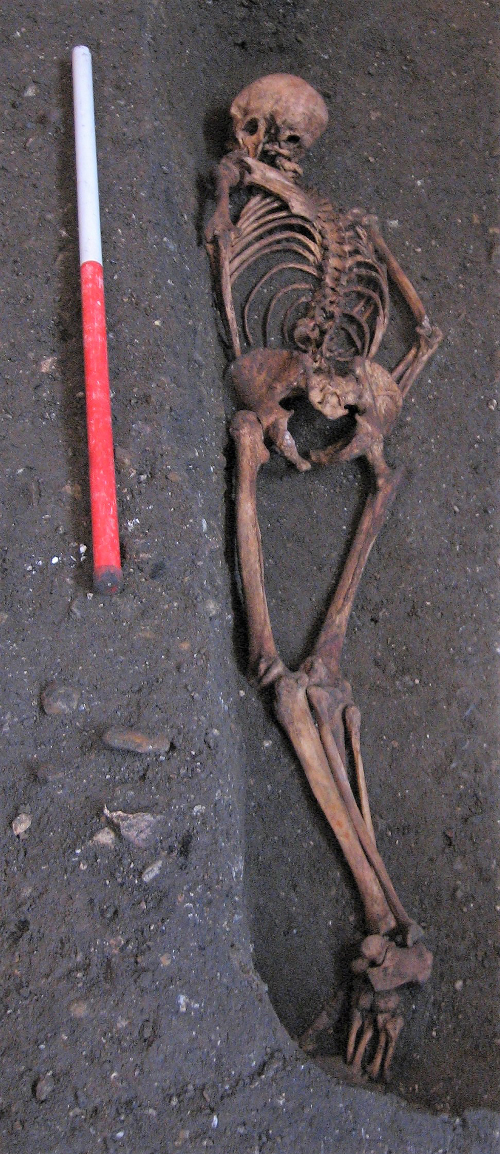 Bioarchaeology International